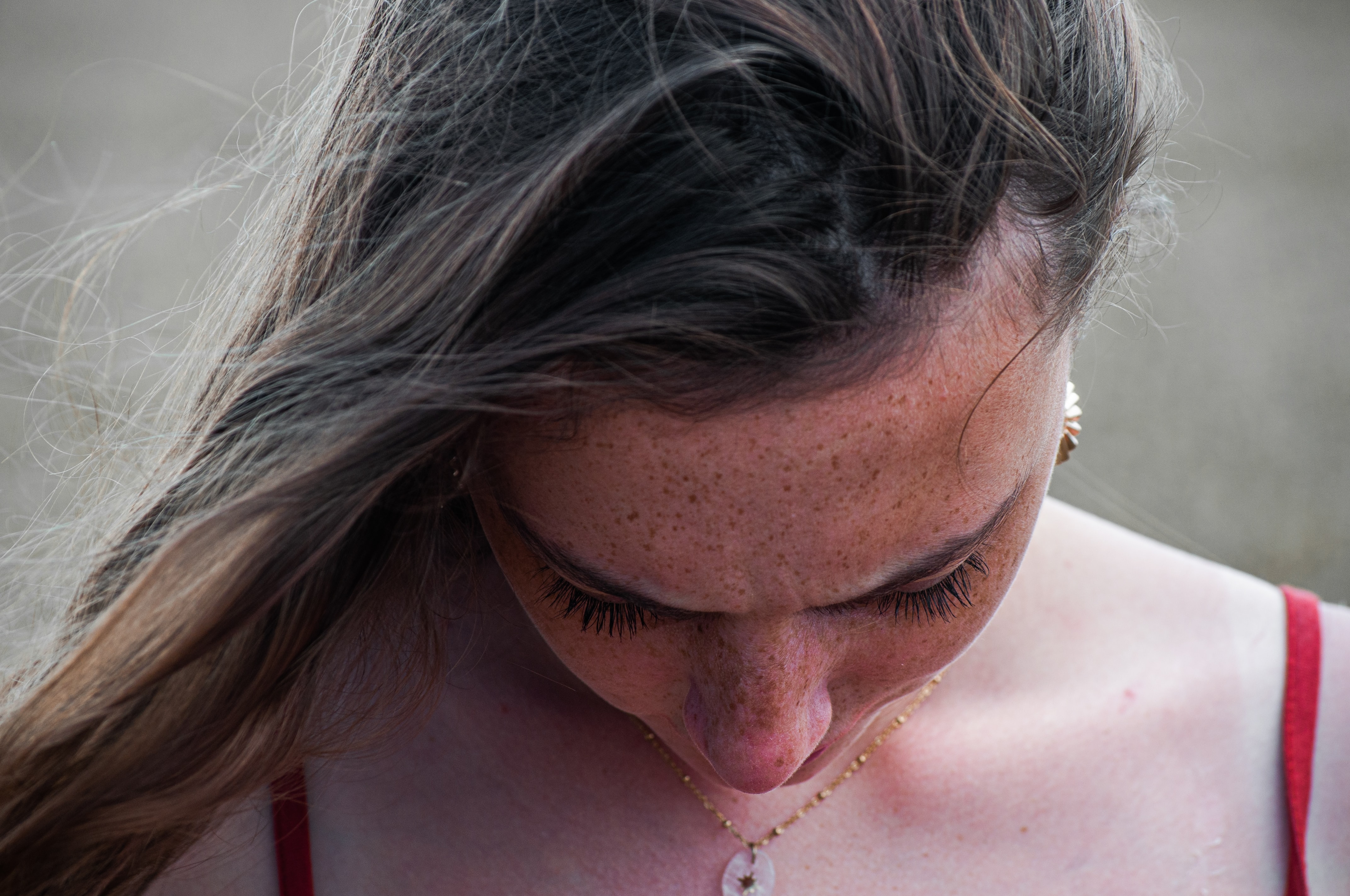 Atentie la culoarea alunitelor! Cele rosii pot anunta boli de ficat sau ...